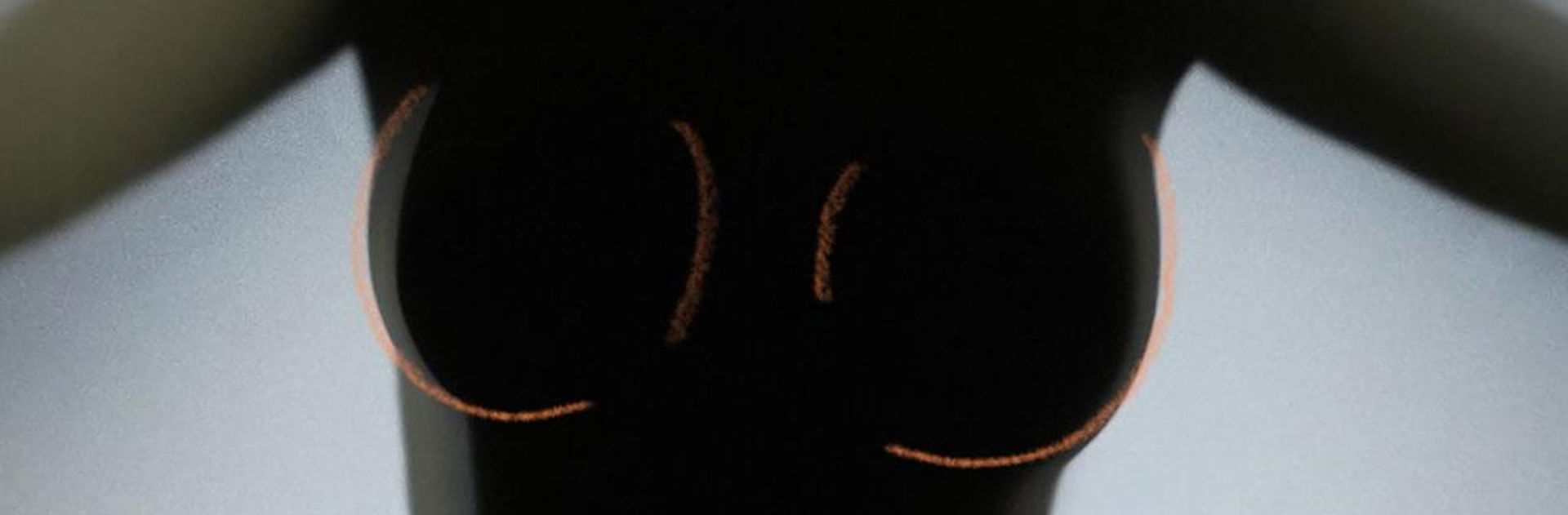 Brustvergrößerung | Dr. med. J.H. Reus | Facharzt für Plastische und Ästhetische Chirurgie in ...